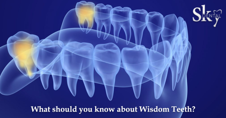 What you need to know about wisdom teeth? - Sky Dental Care