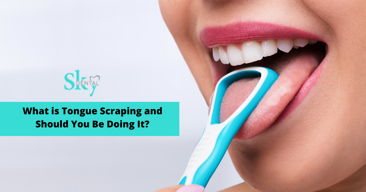 What is Tongue Scraping and Should You Be Doing It?- Sky Dental | Sky ...