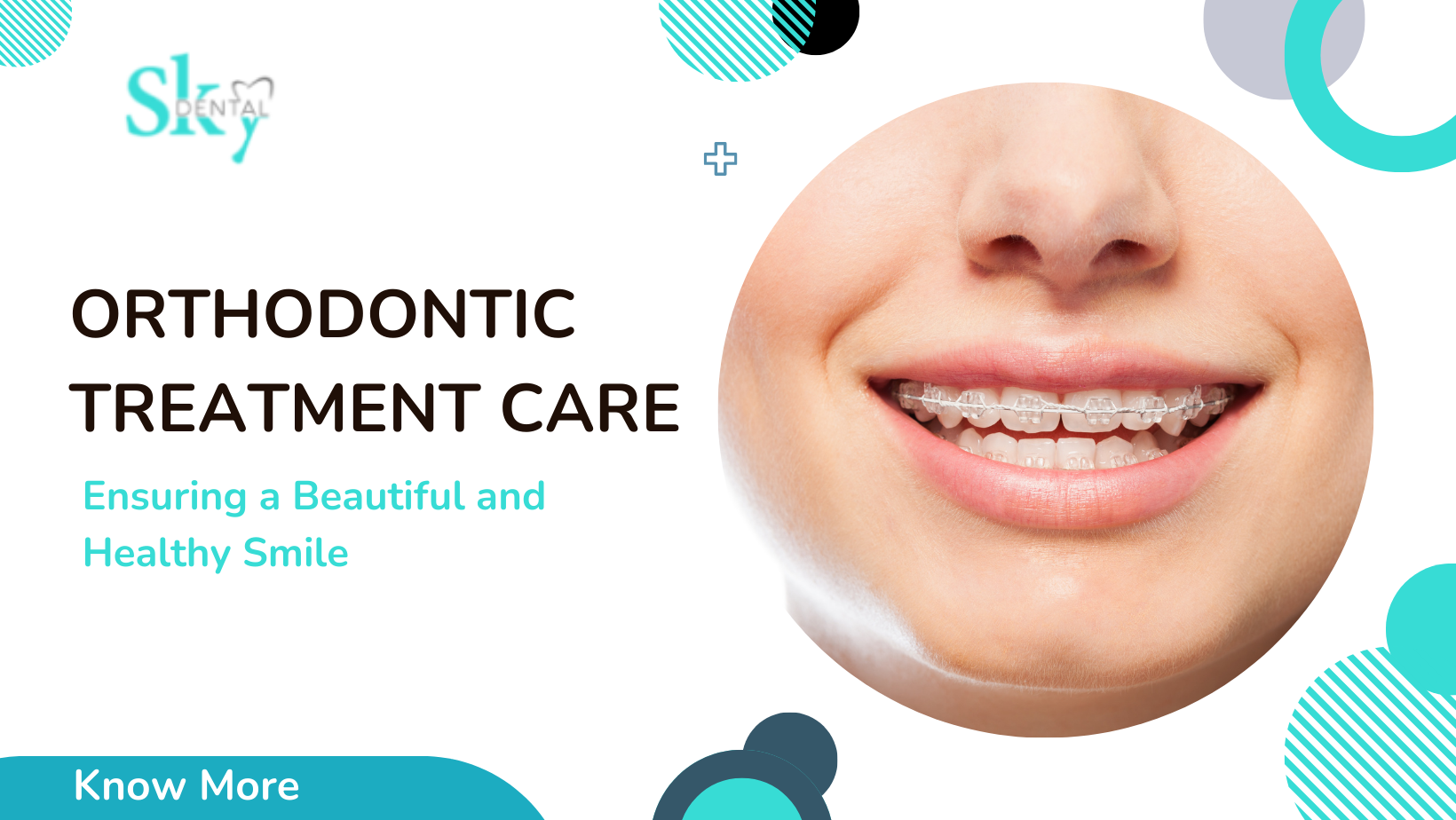 Orthodontic Treatment Care - Ensuring a Beautiful and Healthy Smile