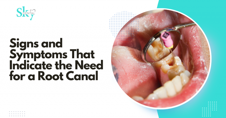Root canal Signs & Symptoms That Indicate the Need for a Root Canal