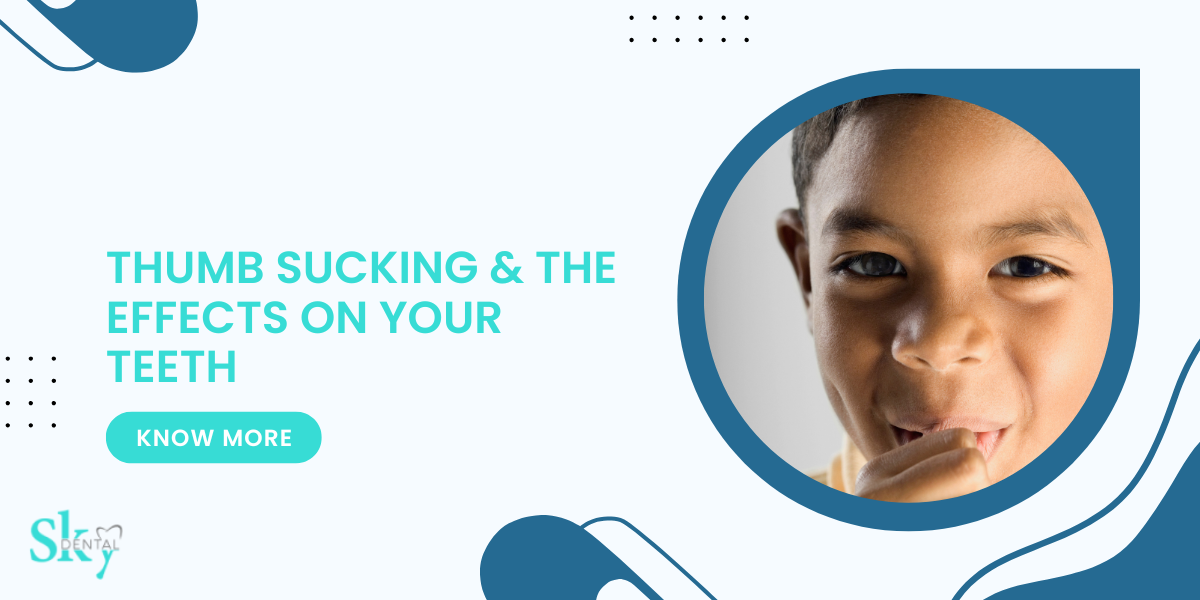 Thumb Sucking & The Effects on Your Teeth - Sky Dental Clinic