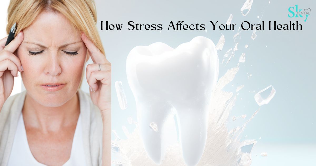 How Stress Affects Your Oral Health and What You Can Do About It